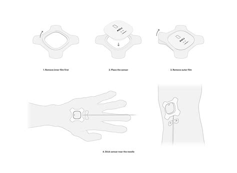 Acu Extravasation Detection System On Behance Medical Videos