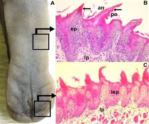 Filiform Papillae Histology