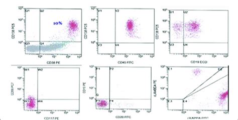 Flow Cytometry On Pleural Fluid Shows An Abnormal Population Of Download Scientific Diagram
