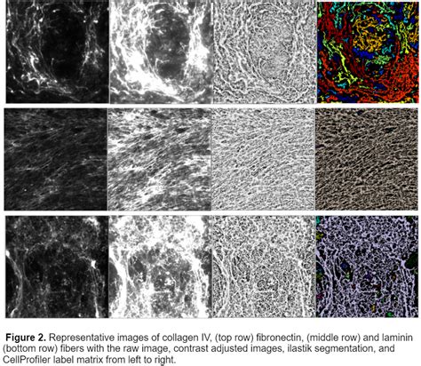 Customizing A Model For Fiber Segmentation Part 4 Analyzing The