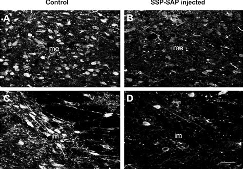 Figure 1 From Cardiac Damage After Lesions Of The Nucleus Tractus