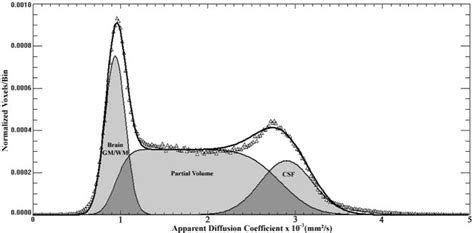 A Whole Brain Adc Histogram From A Representative Patient With Lincl Download Scientific