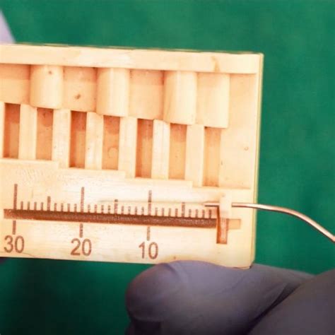 Weines Classification Of Root Canal Configuration Download