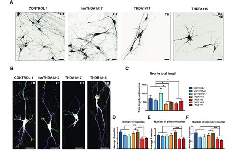 Thd Ipsc Derived Th Neurons Are Morphologically Abnormal A Download Scientific Diagram