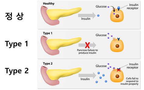 서울내과의원 내분비