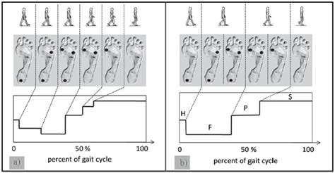 Figure 1 From Statistical Gait Analysis In Patients After Total Hip
