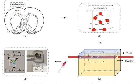 Figure From Multimodal Detection For Cryptogenic Epileptic Seizures Based On Combined Micro