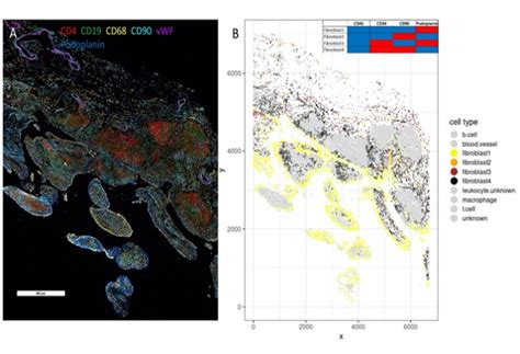 Locating Cellular Subsets In Rheumatoid Arthritis Synovium Using Co