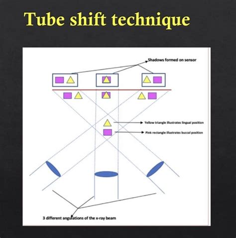 Radiology Object Localization Extra Oral Radiography And Advanced Imaging In Dentistry