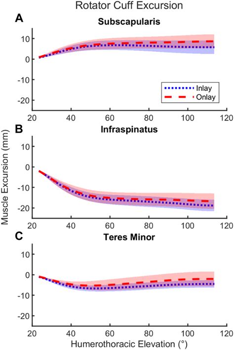 Inlay Vs Onlay Humeral Components In Reverse Total Shoulder