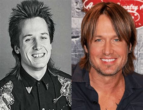Celebs With The Most Dramatic Teeth Transformation Smilebar