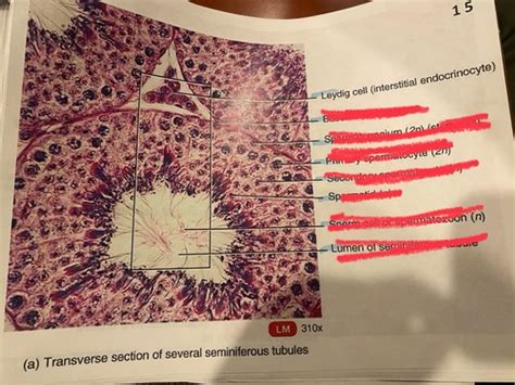 Histology Of Sperm 2 Flashcards Quizlet