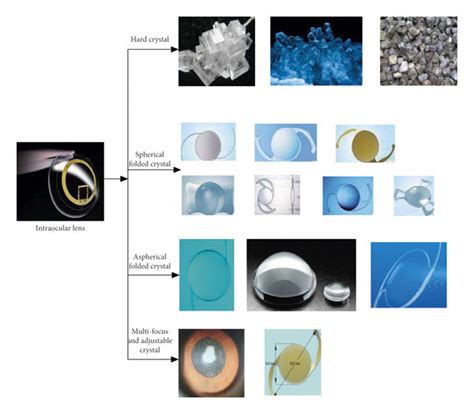 Specific Classification Of Intraocular Lenses Download Scientific Diagram