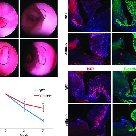 Transgenic Villin Proteins Are Functional And Villin Severing Activity Download Scientific