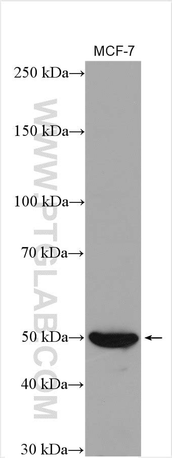 Runx2 Antibody 20700 1 Ap Proteintech