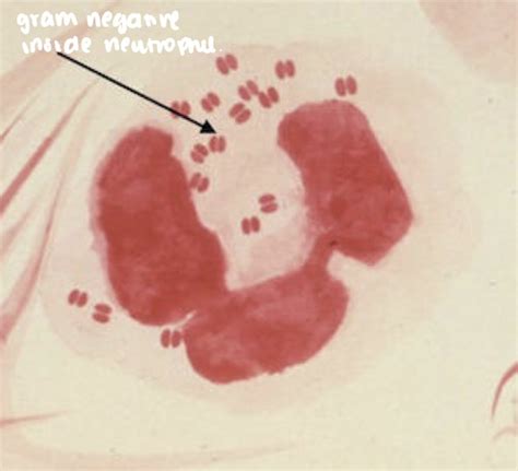Nature And Pathogenesis Of Infection Flashcards Quizlet