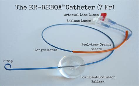 Reboa Resuscitative Endovascular Balloon Occlusion Of The Aorta