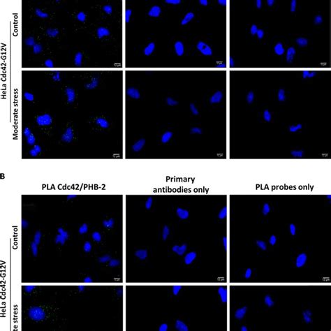 Proximity Ligation Assay Pla Confirms The Proximal Actions And Download Scientific Diagram