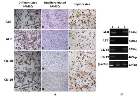 Hepatic Differentiation Of Hpmscs A Immunocytochemistry Analysis Of