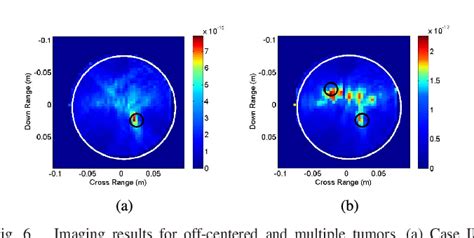 Figure 1 From A Time Reversal Based Microwave Imaging System For Detection Of Breast Tumors