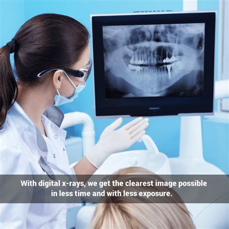 The Benefits Of Digital Dental X Rays Dental Partners Of Boston