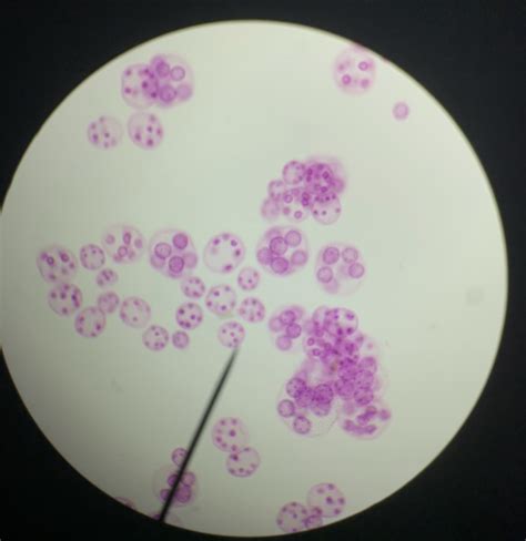 Bio1108l Protist Images Matching Flashcards Quizlet