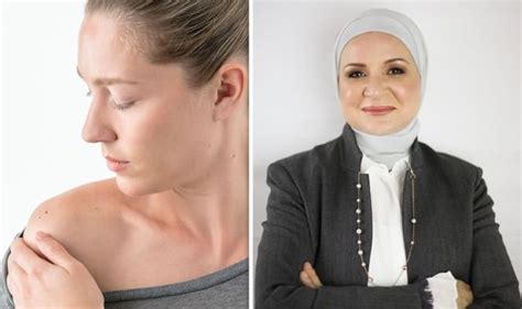 Skin Cancer Is Your Mole Cancerous An Expert Shares What To Look Out For Express Co Uk