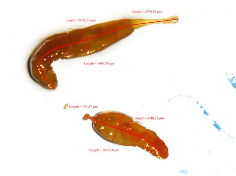 Which Kind Of Acantocephala Species Are On The Figure Researchgate
