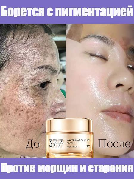 377 Отбеливающий антивозрастной крем от пигментных пятен и веснушек Увлажняющий осветляющий