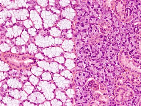 Salivary Gland Histology Submandibular Gland Labels