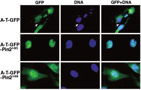 Dominant Negative Pin2t Rf1 Mutants Reduce The Radiosensitivity Of