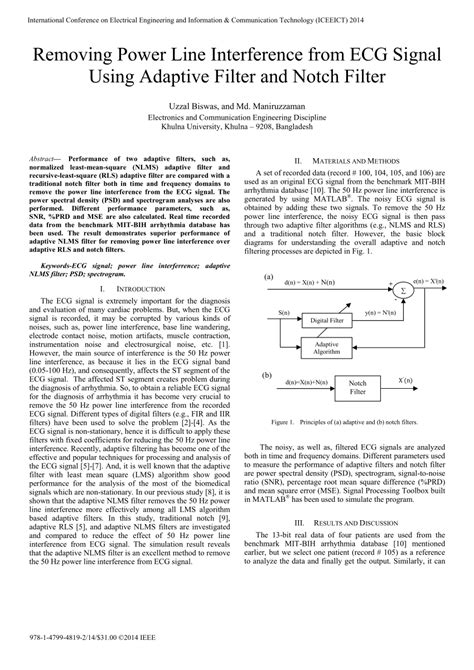 Pdf Removing Power Line Interference From Ecg Signal Using Adaptive Filter And Notch Filter