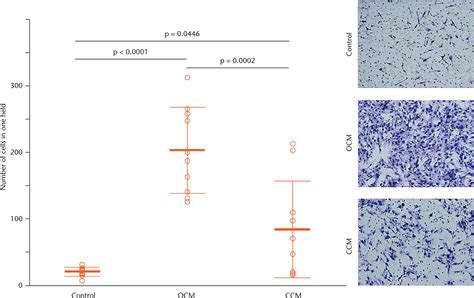 Characterisation Of Osteophytes As An Autologous Bone Graft Source Bone And Joint