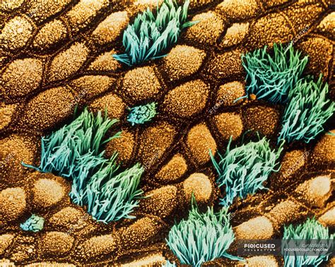 Coloured Scanning Electron Micrograph Sem Of Epithelial Cells Lining The Human Trachea