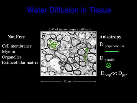 PPT Introduction To Diffusion Weighted Imaging PowerPoint Presentation ID