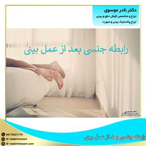 رابطه جنسی بعد از عمل بینی بایدها و نبایدها