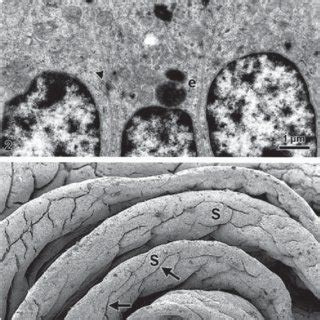 Transmission Electron Micrograph Of The Non Ciliated Simple Columnar Download Scientific
