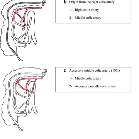 Right Colic Artery A Origin From The Superior Mesenteric Artery 1