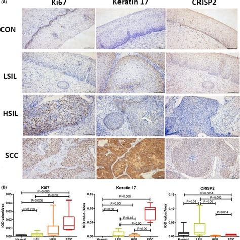 Representative Immunohistochemical Ihc Staining A And Download Scientific Diagram