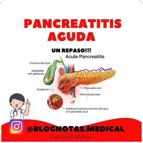 Pancreatitis Aguda Blognotasmedical Udocz