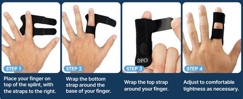Why Splint Trigger Finger At Hunter Berry Blog