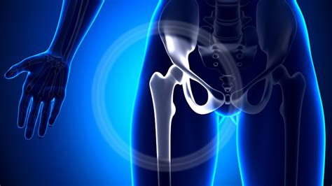 Hip Replacement Patients May Need To Delay Invasive Dental Care