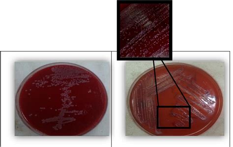 Figure 1 From Estimation Of The In Vitro Synergistic Effect Of Vancomycin With Bacteriophage And