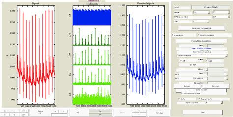 Multiwavelet Denoising For Ecg Record No 103 M Using Biorthogonal 1d