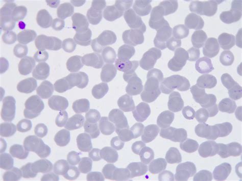 Yolov11 Object Detection Dataset By Unamed