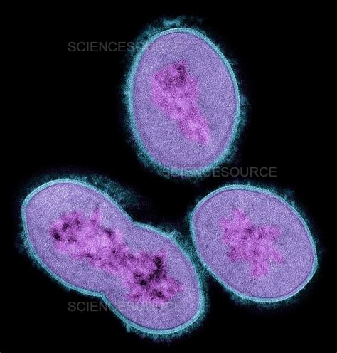 Streptococcus Bacteria Tem Stock Image Science Source Images
