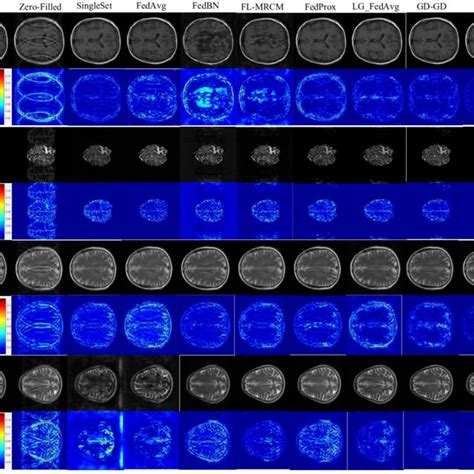 Qualitative Comparison Of Different Methods In Terms Of Reconstruction