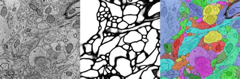 automatic segmentation of neural tissue in 3d electron microscopy
