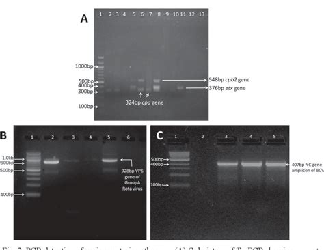Figure 2 From Molecular Detection Of Clostridium Perfringens