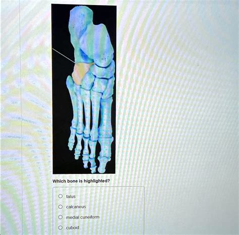 Which Bone Is Highlighted Talus Calcaneus Medial Cuneiform Cuboid Which Bone Is Highlighted